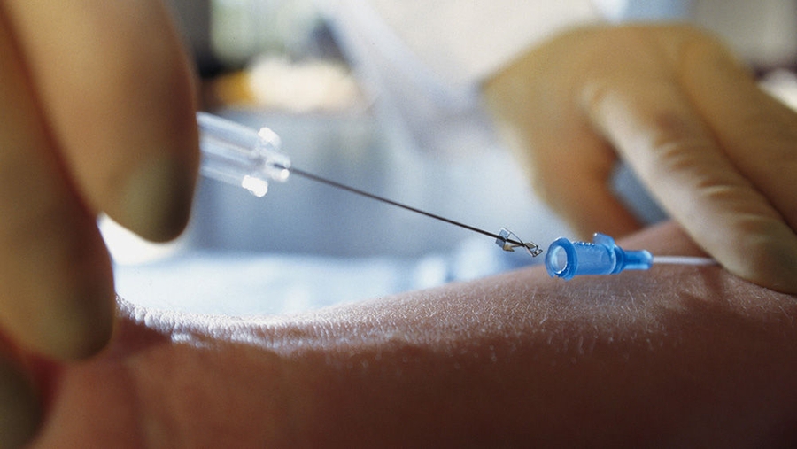 Vascular Access Management